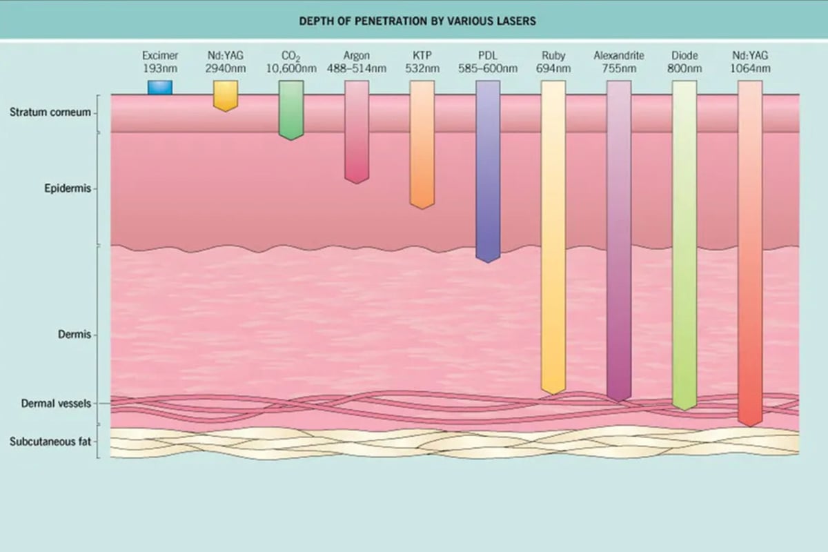 Skin Laser Treatment Singapore Dr Plus Aesthetic Clinic